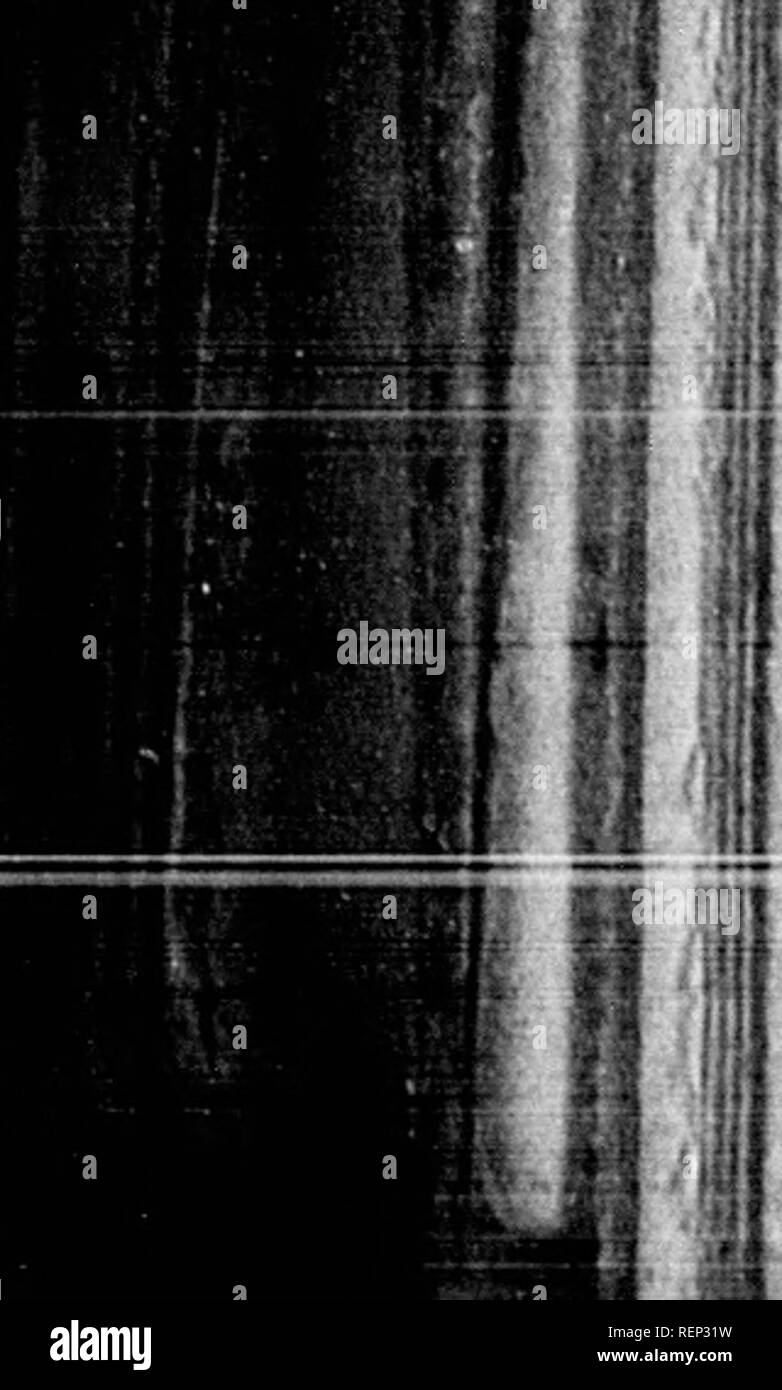 Leprose Black and White Stock Photos & Images - Alamy