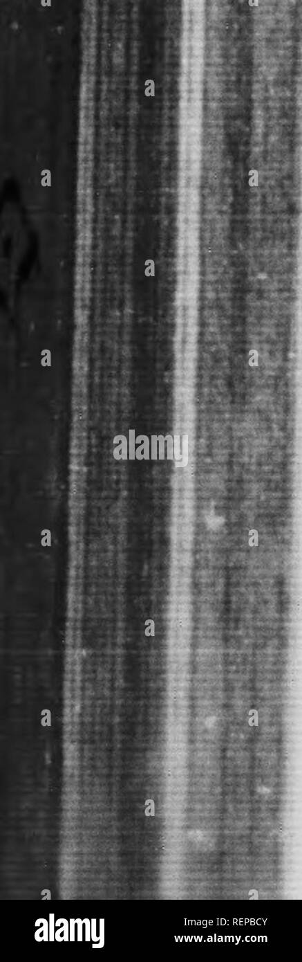 Cardinal teeth Black and White Stock Photos & Images - Alamy