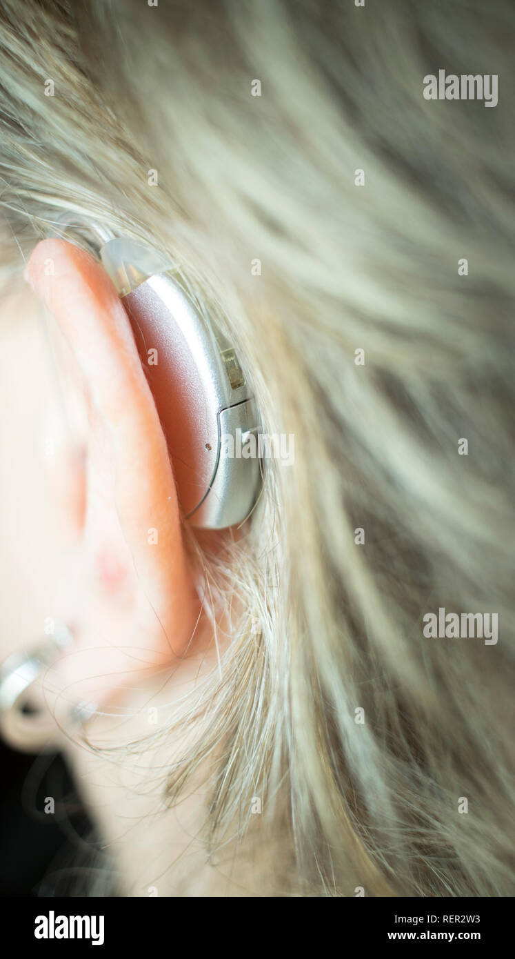 Deaf lady with modern technology digital hearing aid in her ear Stock ...
