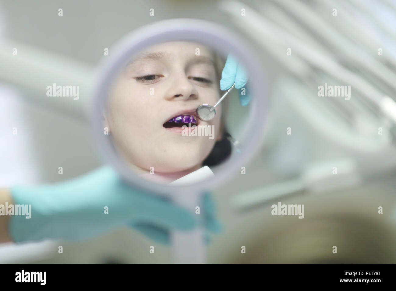 Doctor head mirror hi-res stock photography and images - Alamy