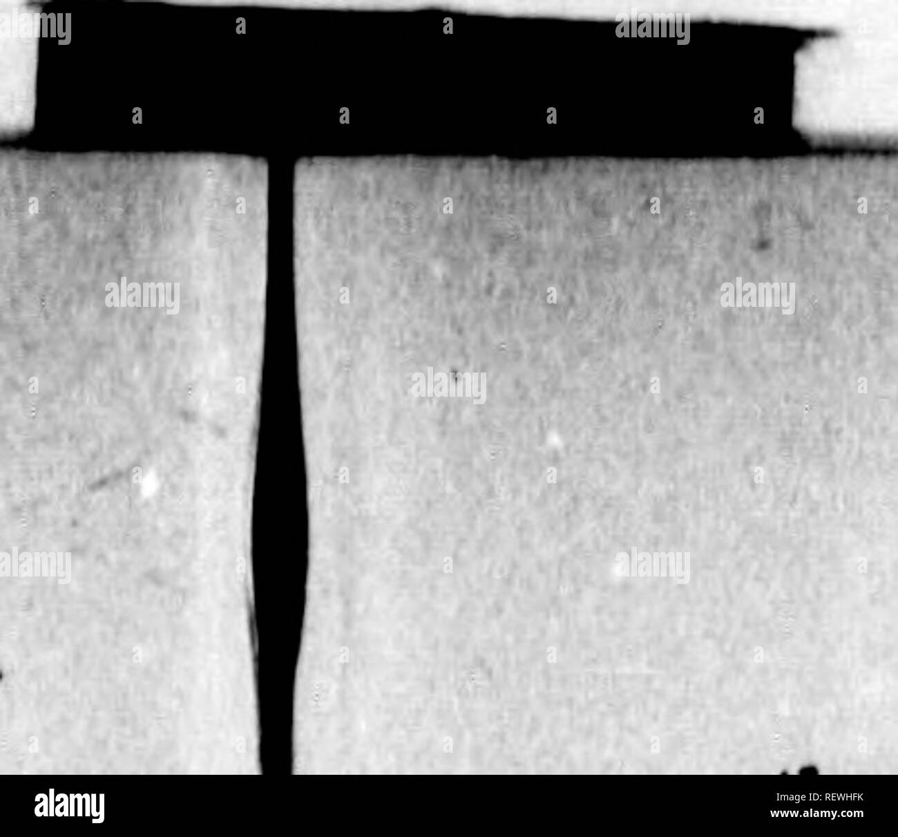 Radicular Black and White Stock Photos & Images - Alamy