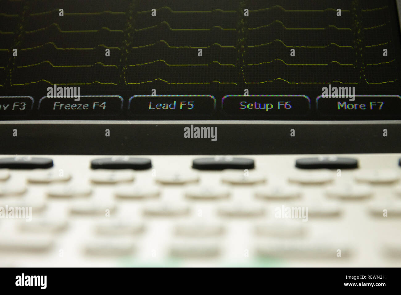 Electrocardiograph medical device with screen and keyboard, front view ...