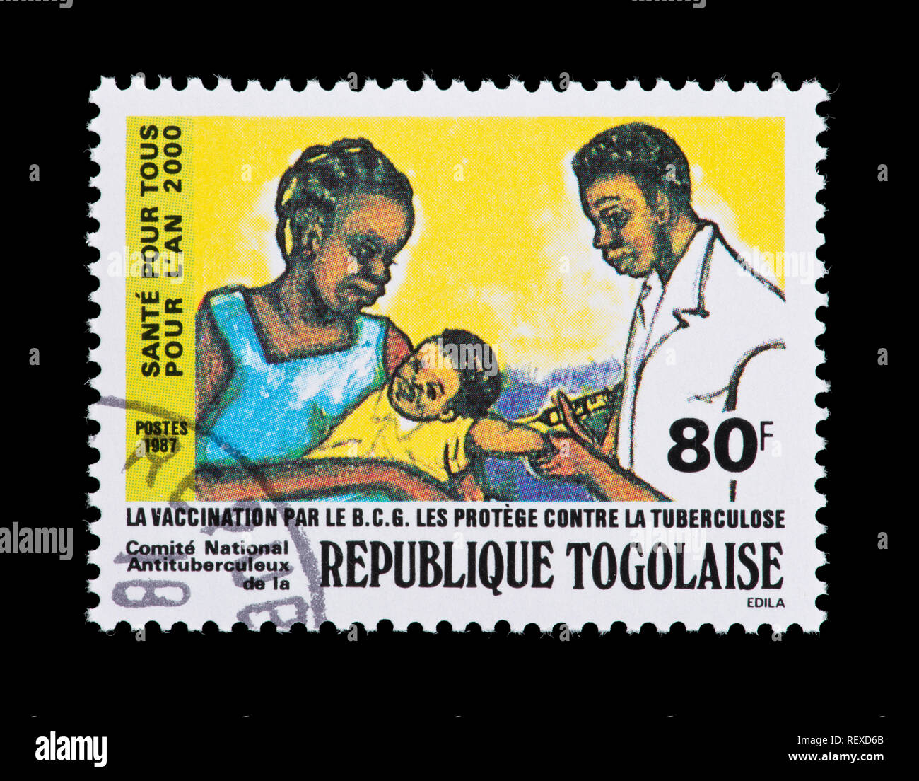 Tuberculosis vaccination hi-res stock photography and images - Alamy