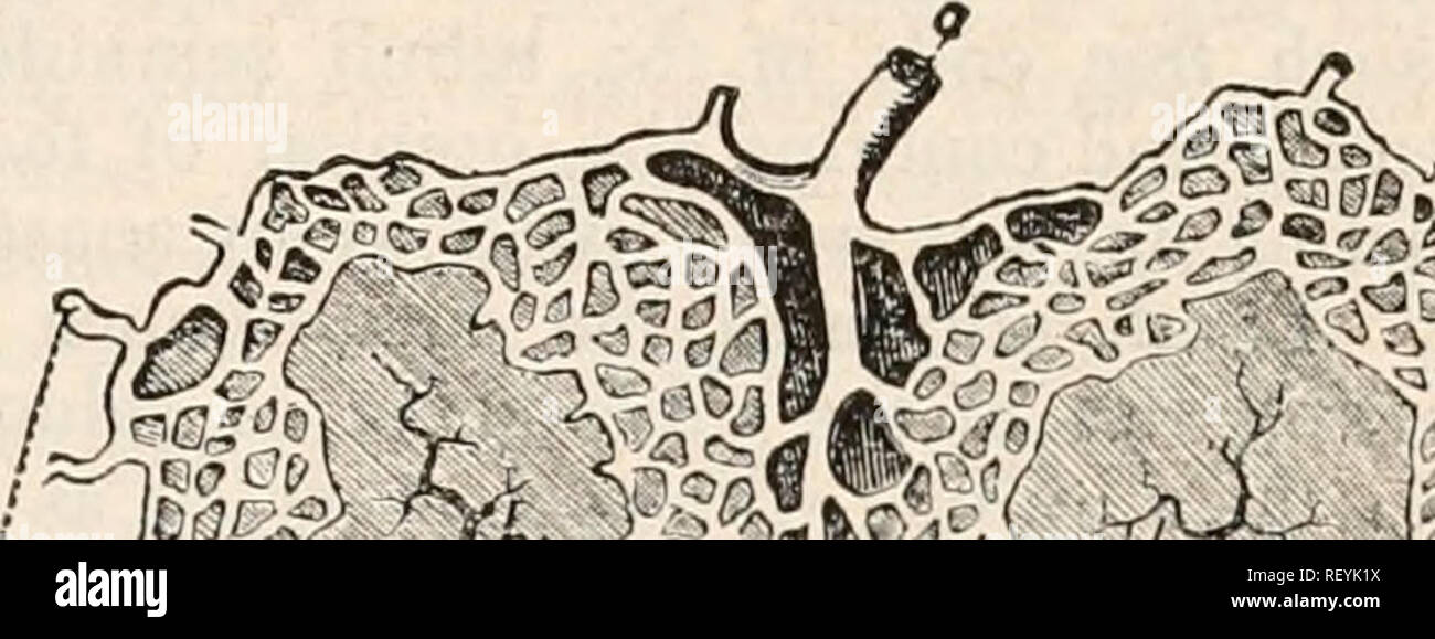 Interlobular fissure hi-res stock photography and images - Alamy