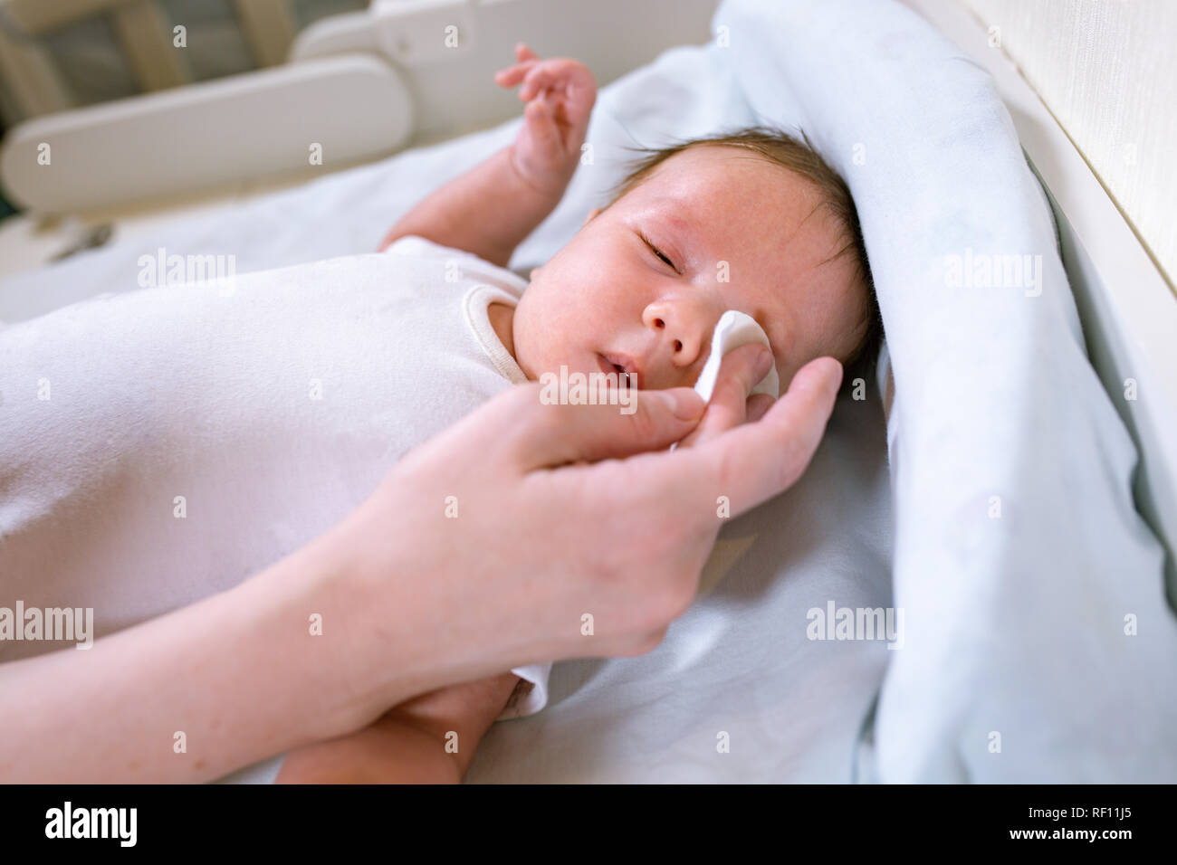 Conjunctivitis newborn hi-res stock photography and images - Alamy