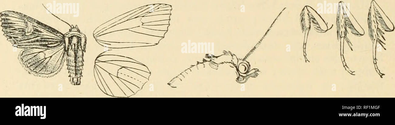 Red lines abdomen hi-res stock photography and images - Alamy