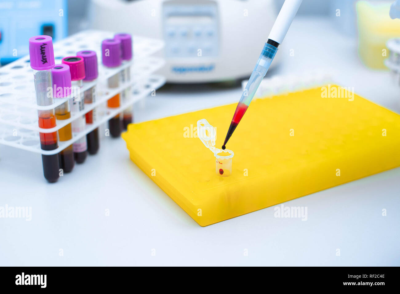 Dna test in the lab. Dispenser with blood and test tubes close-up. A ...