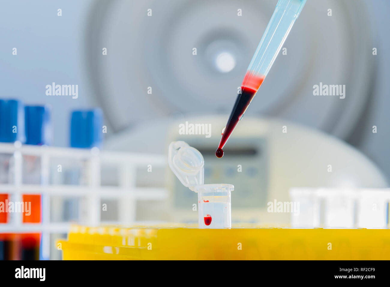 Dna test in the lab. Dispenser with blood and test tubes close-up. A ...