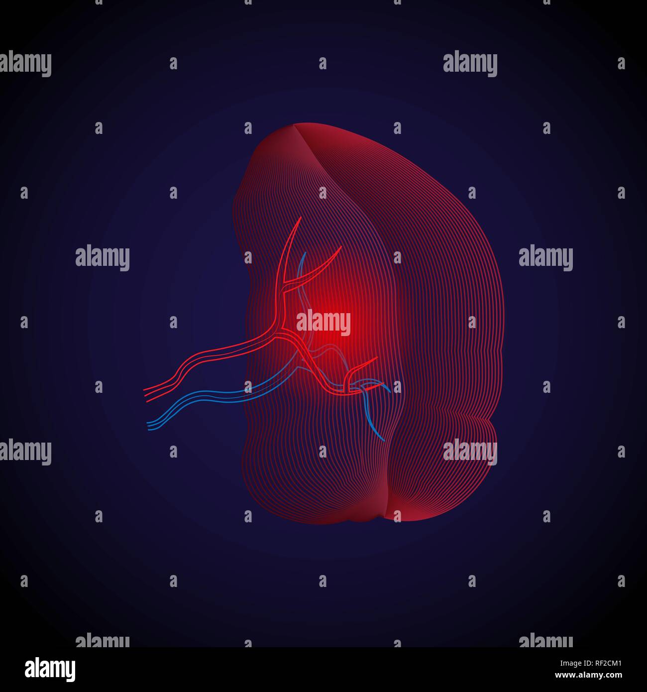 Medical illustration of the lines.. X-ray effect of spleen disease ...