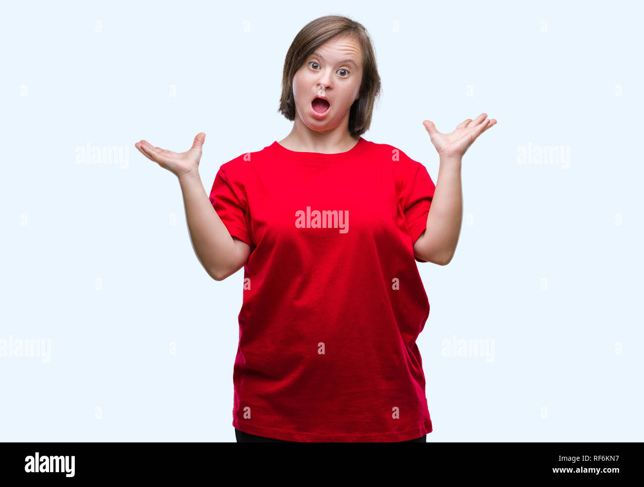 Young adult woman with down syndrome over isolated background ...