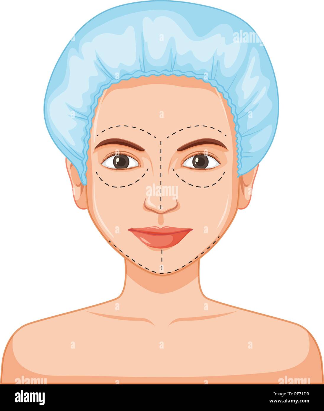 Lady facial skin botox illustration Stock Vector Image & Art - Alamy