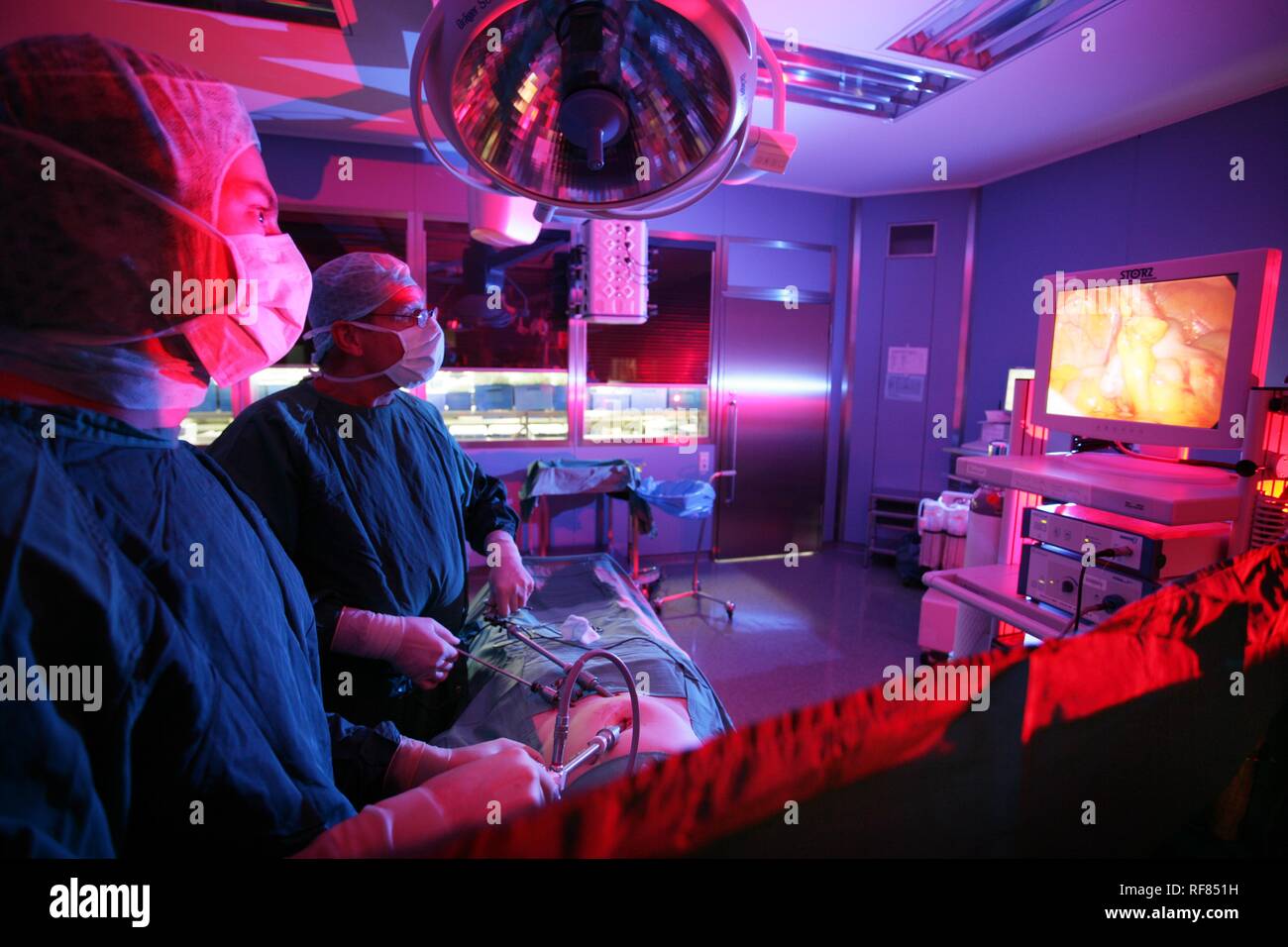 Laparoscopic surgery, appendix operation, Germany Stock Photo - Alamy