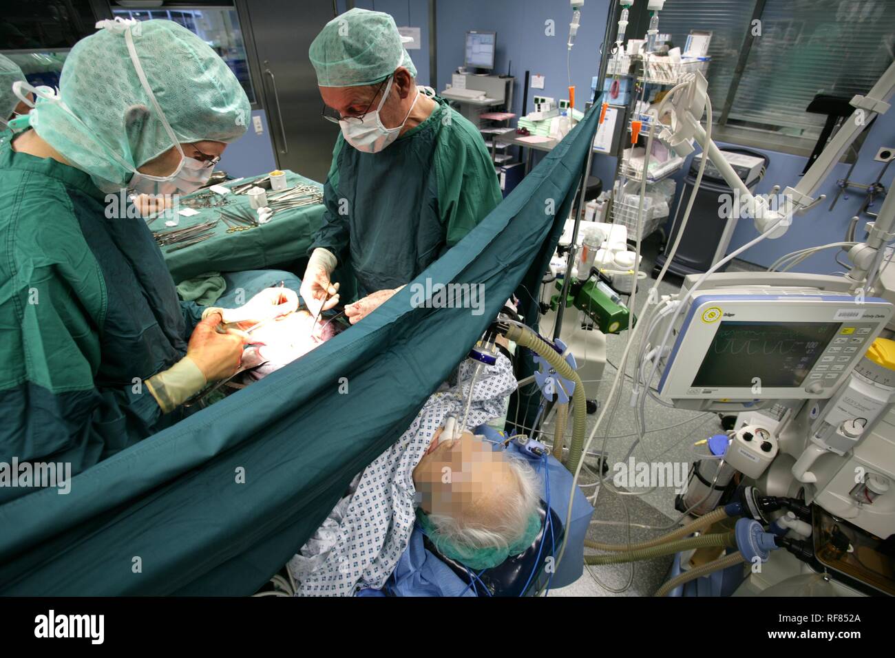 Colon operation, removal of tumour, Germany Stock Photo - Alamy
