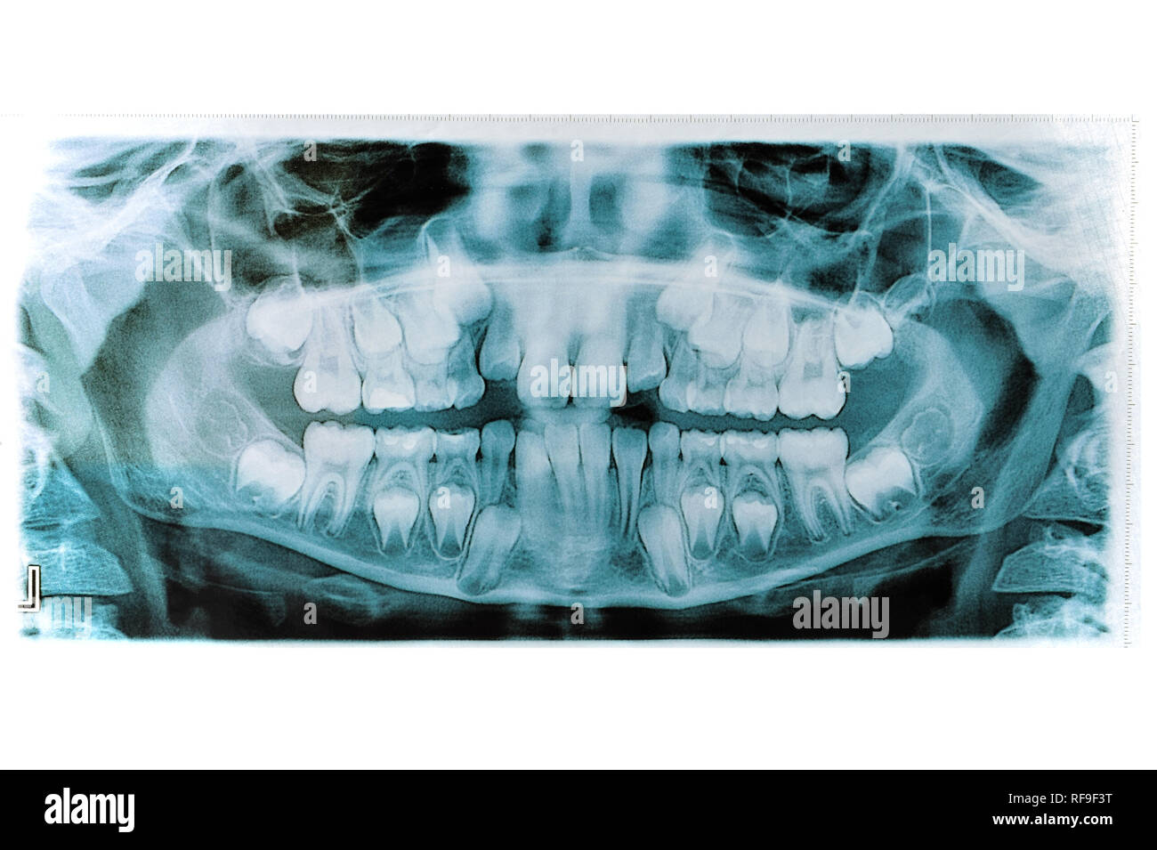 Human jaws Cut Out Stock Images & Pictures - Alamy