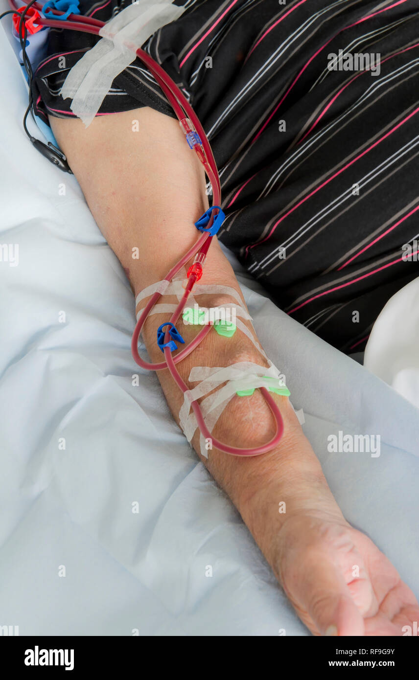 Renal unit hi-res stock photography and images - Alamy