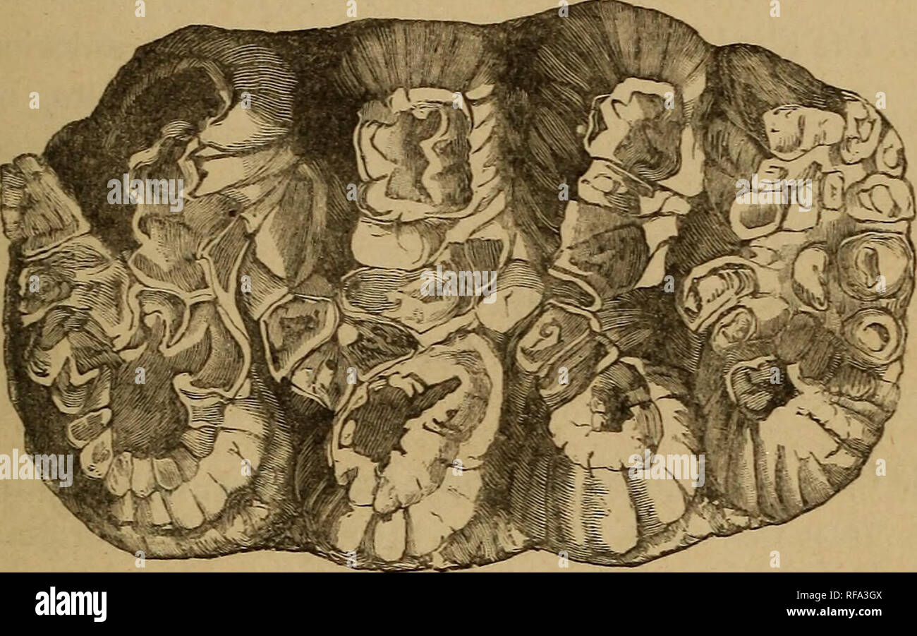 Mandibular molars hi-res stock photography and images - Alamy