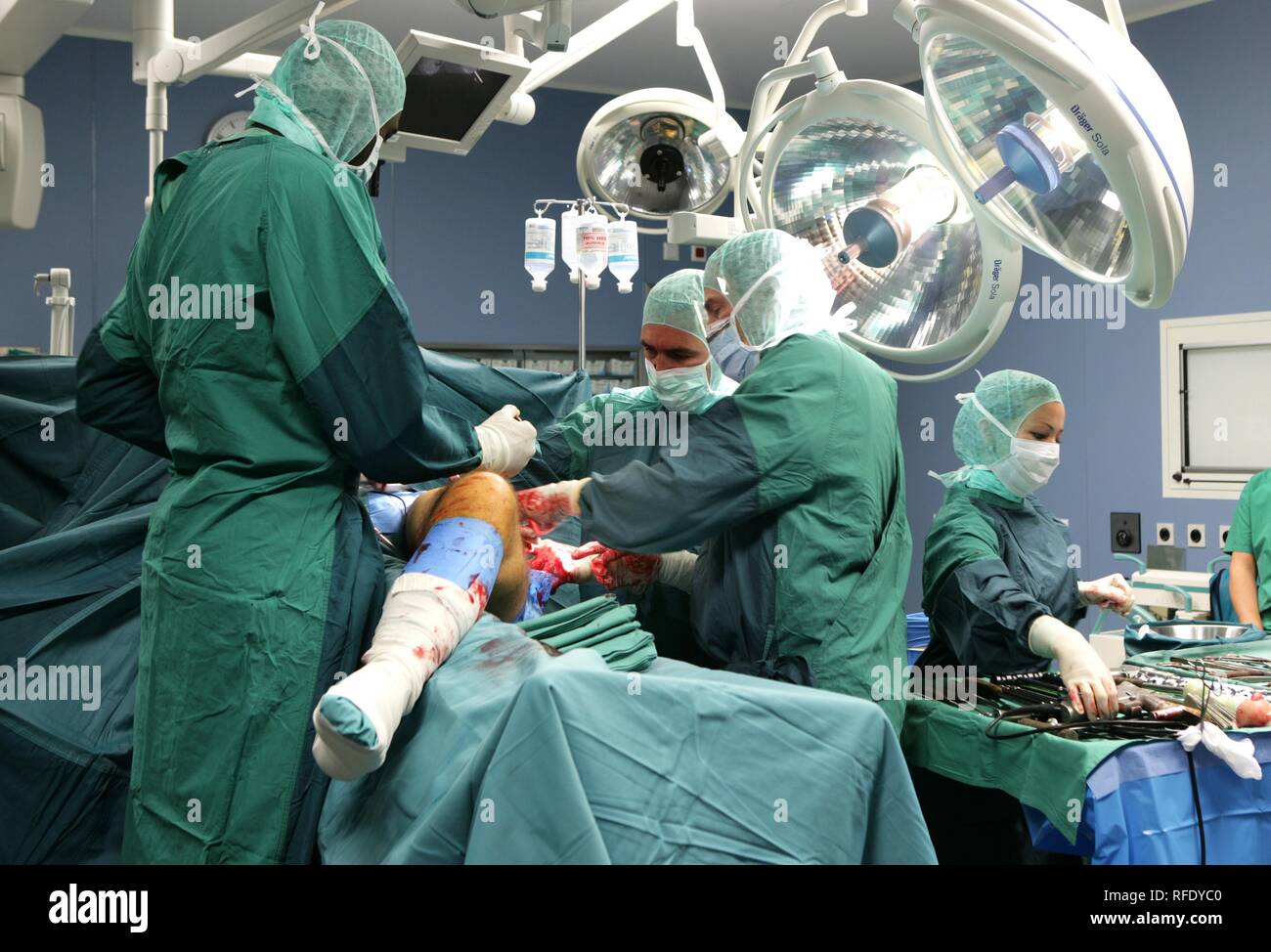 Hip replacement, operation Stock Photo - Alamy