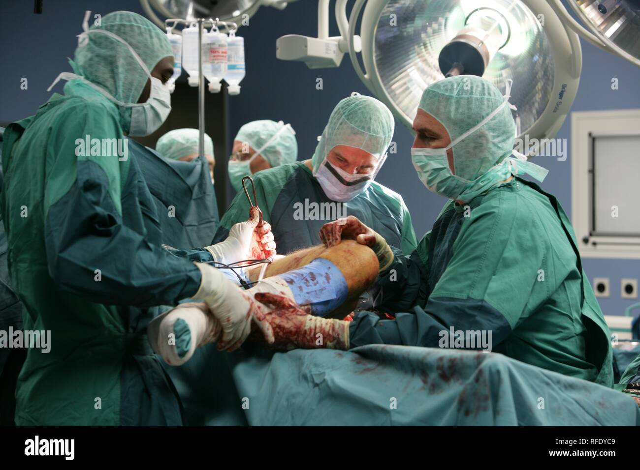 Hip replacement, operation Stock Photo - Alamy