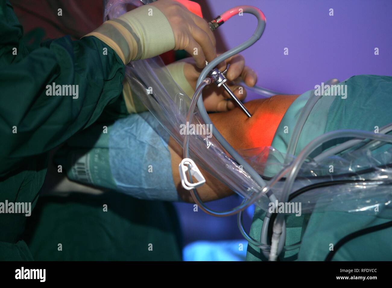 Arthroscopic surgery of knee joint Stock Photo - Alamy