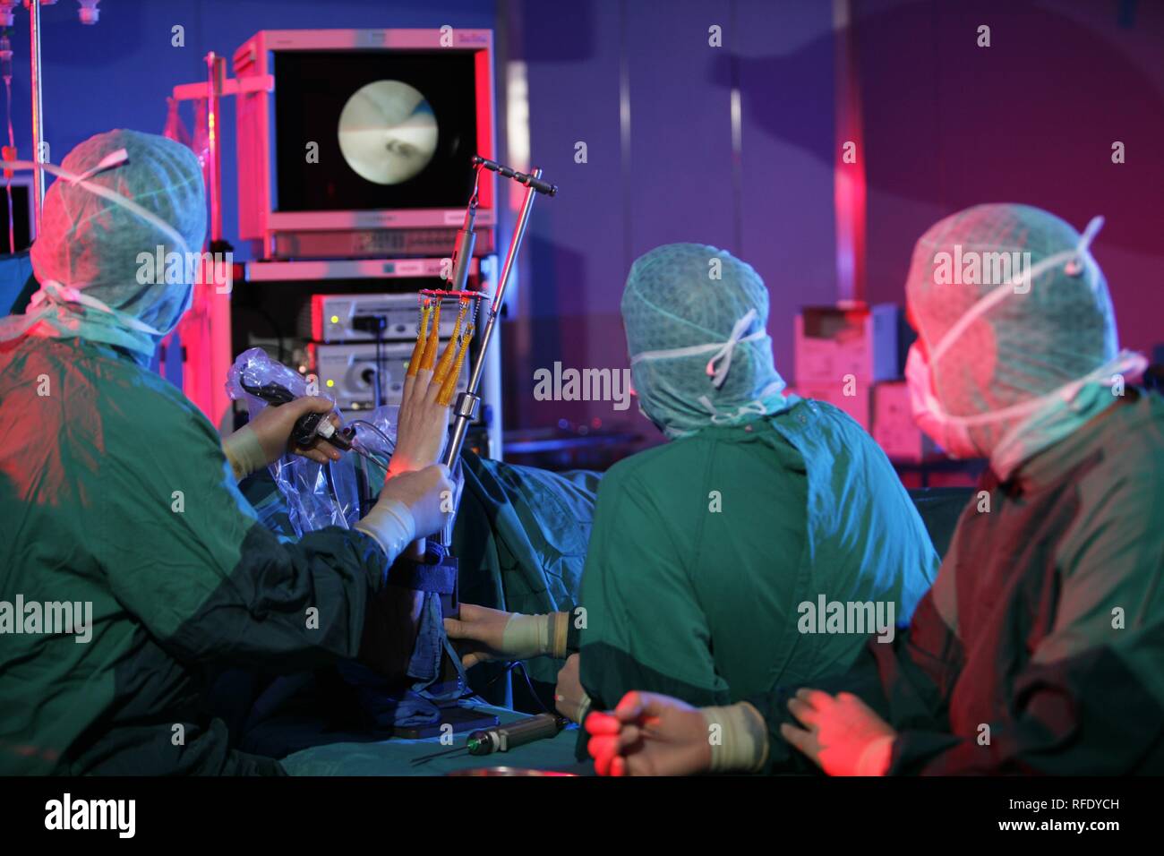 Arthroscopic surgery of a wrist. Surgeon sees the joint on the monitor ...