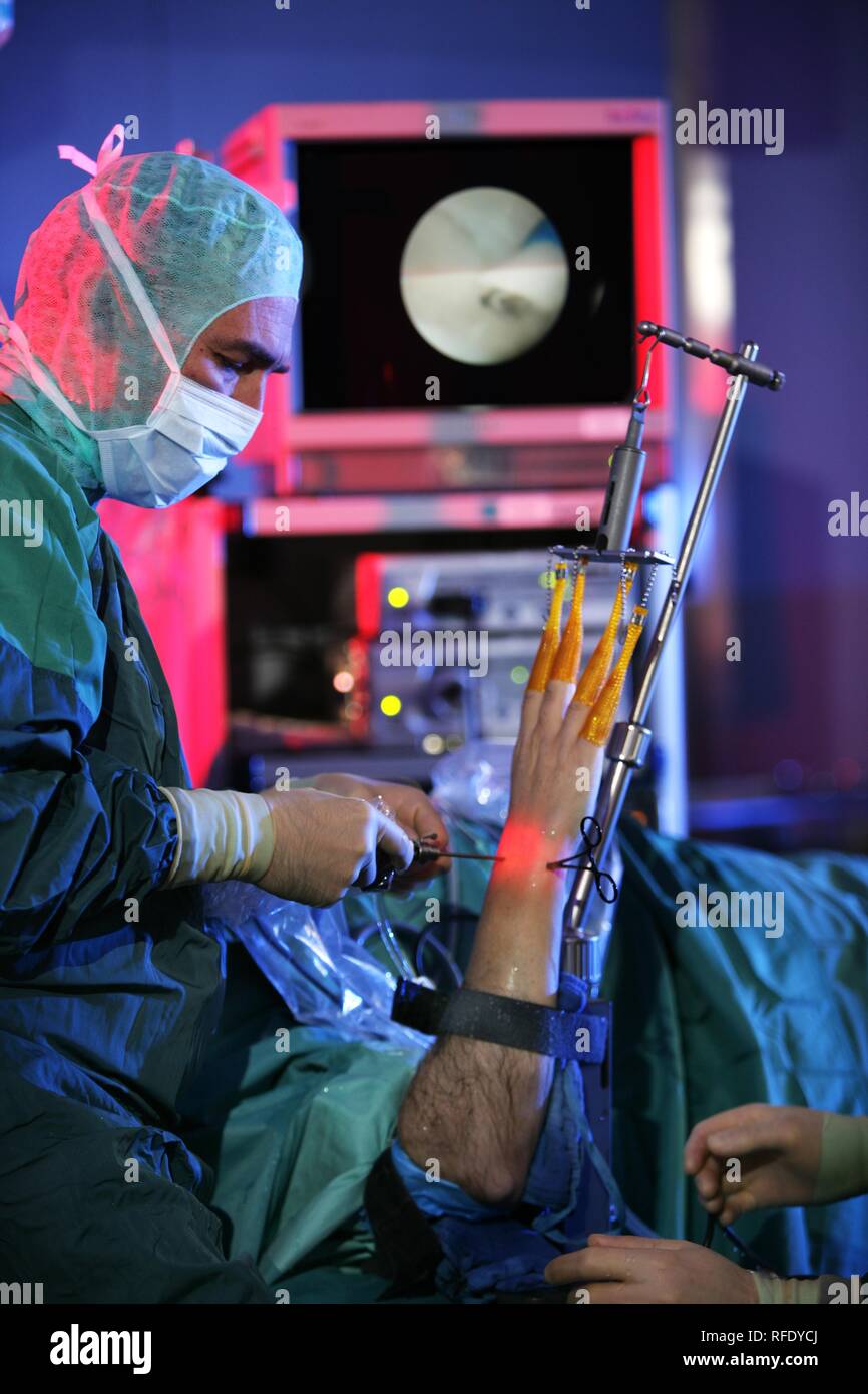 Arthroscopic Surgery Of A Wrist Surgeon Sees The Joint On The Monitor