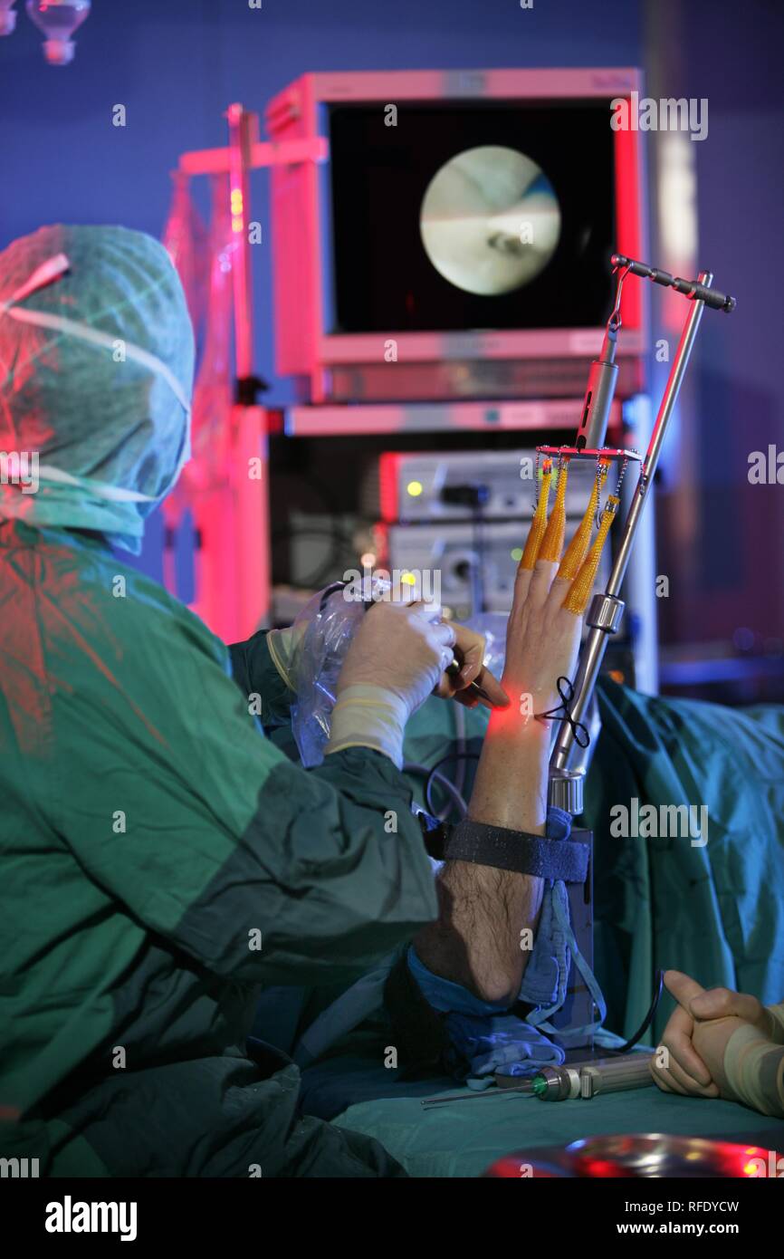 Arthroscopic surgery of a wrist. Surgeon sees the joint on the monitor ...