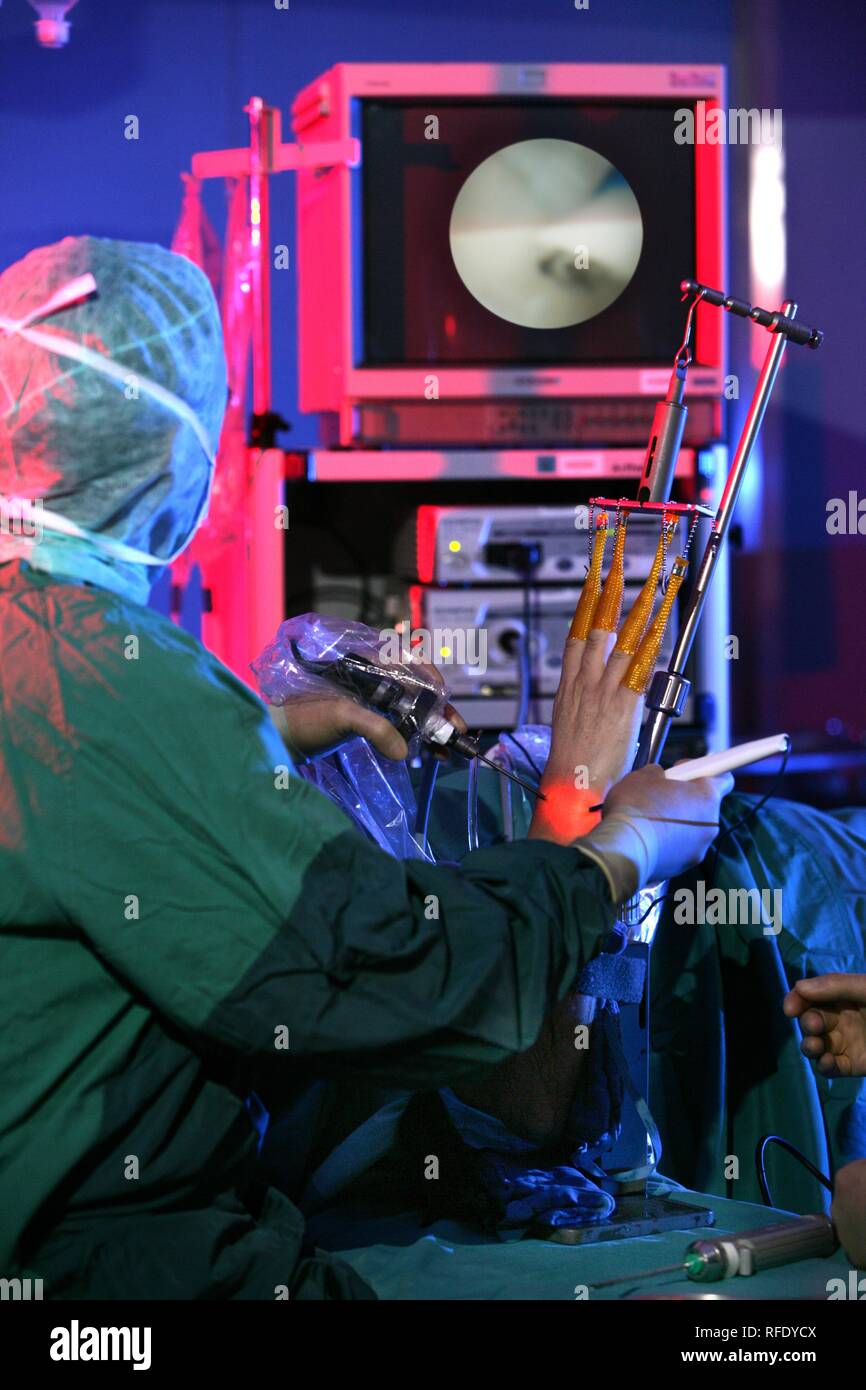 Arthroscopic surgery of a wrist. Surgeon sees the joint on the monitor ...