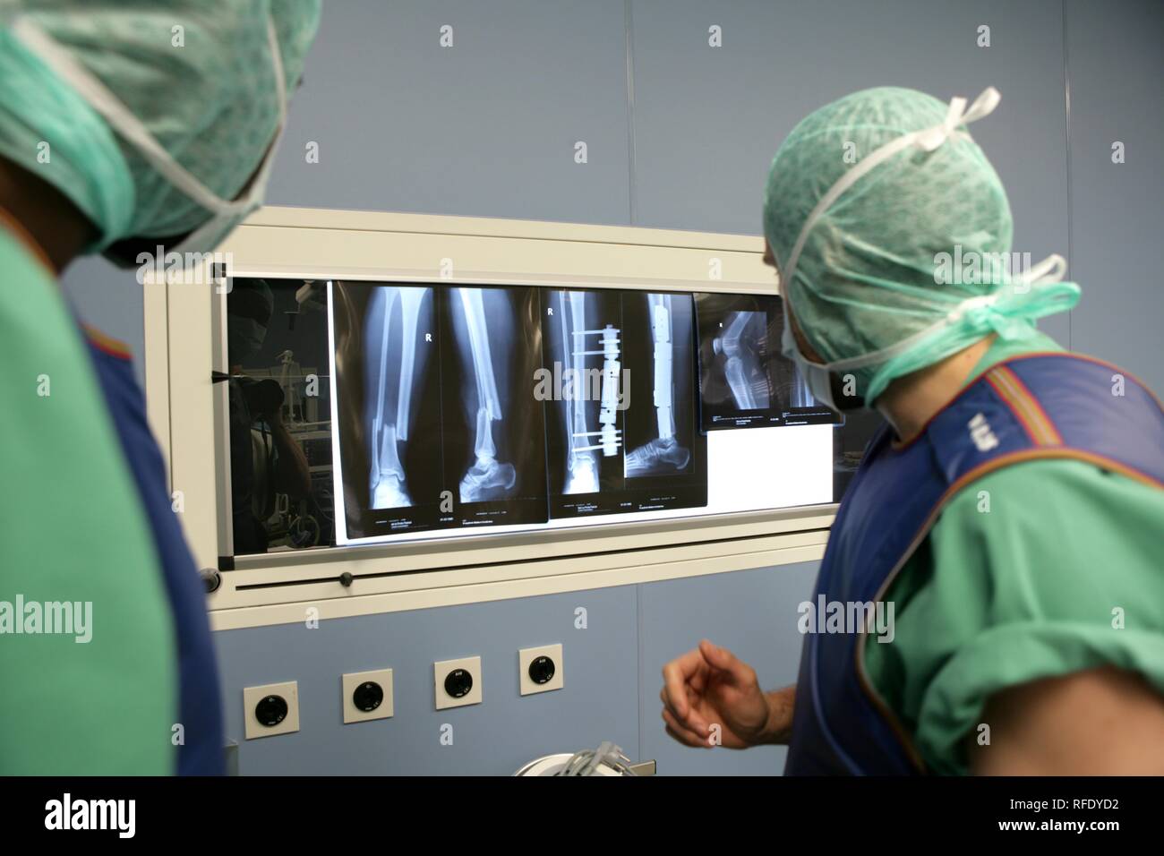 Leg x ray hi-res stock photography and images - Alamy