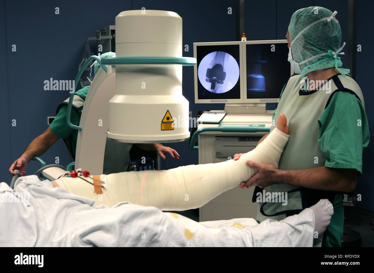 Knee replacement, artifical knee joint, operation Stock Photo - Alamy