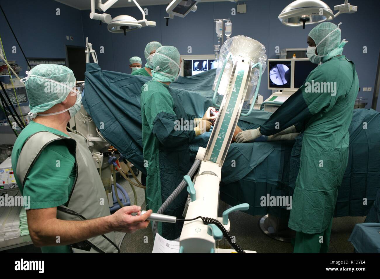 X-ray of fracture during an operation Stock Photo - Alamy