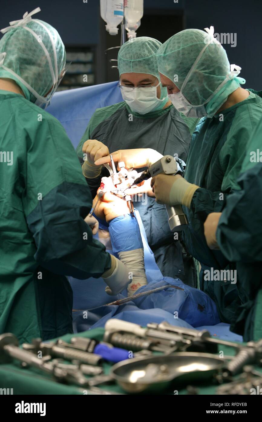 Knee replacement, artifical knee joint, operation Stock Photo - Alamy