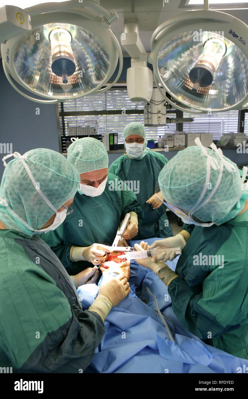 Knee replacement, artifical knee joint, operation Stock Photo - Alamy