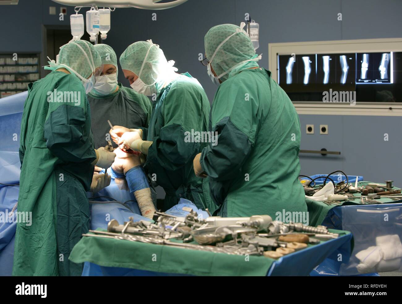 Knee replacement, artifical knee joint, operation Stock Photo - Alamy