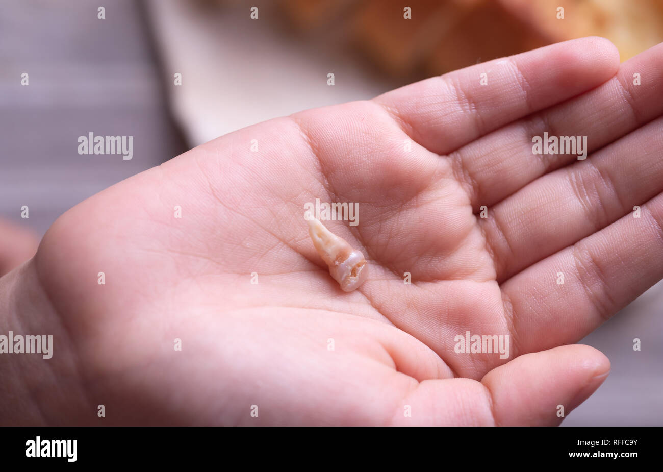 Child show the loose tooth in hand Stock Photo - Alamy