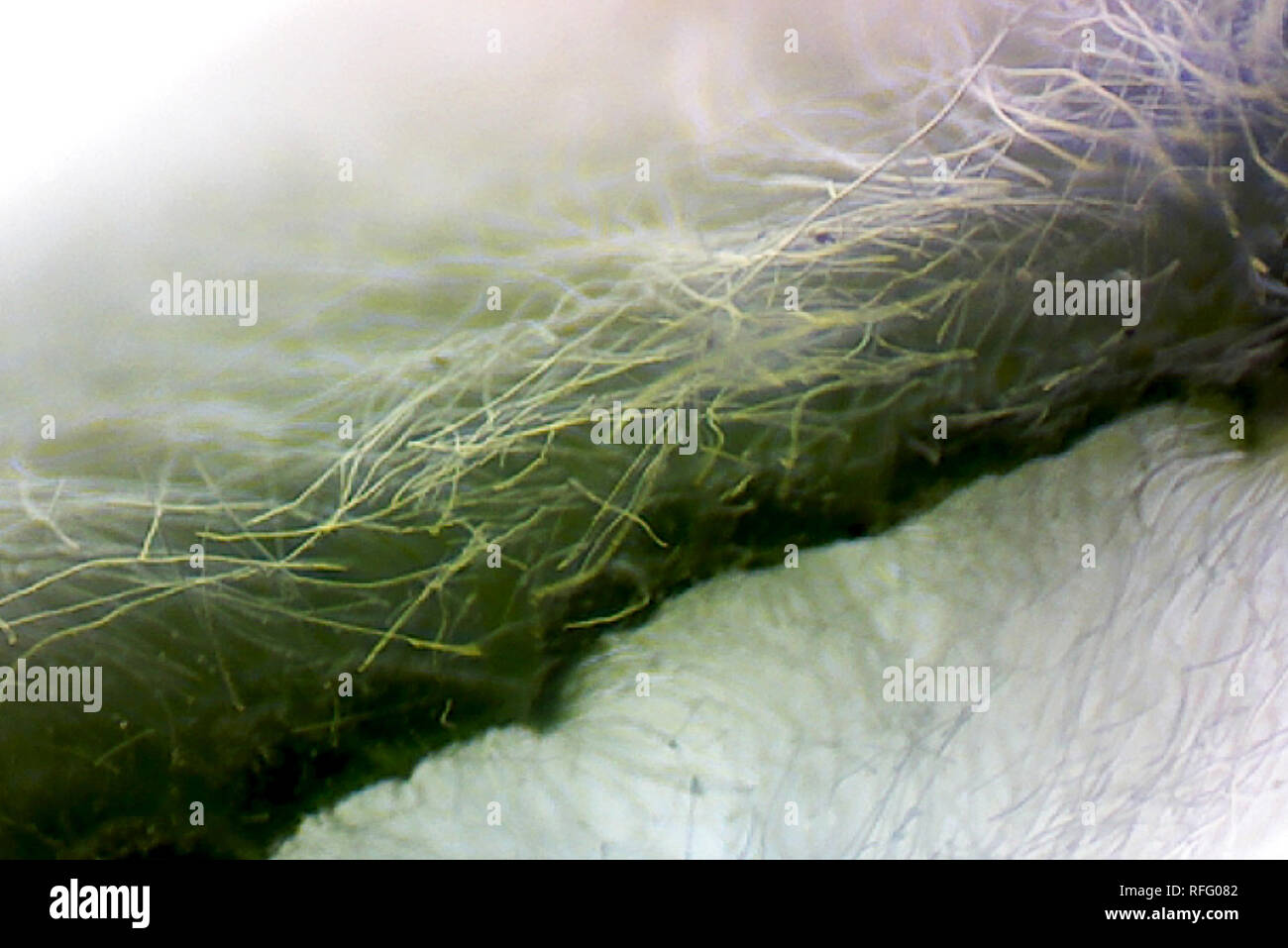 Ear microscope hi-res stock photography and images - Alamy