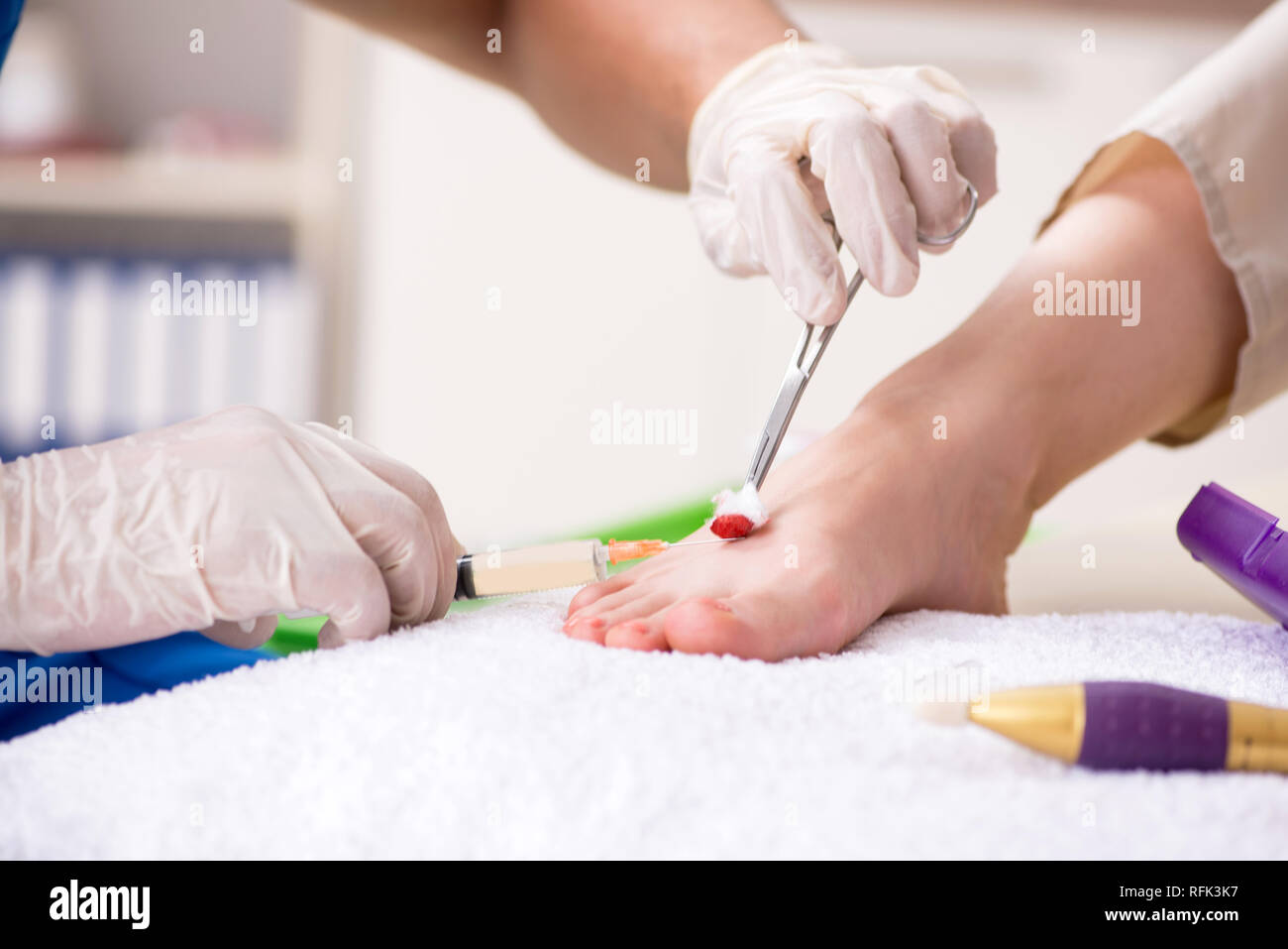 Podiatrist treating feet during procedure Stock Photo - Alamy