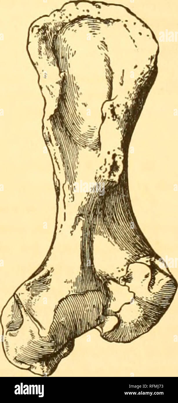 Frontonasal Suture