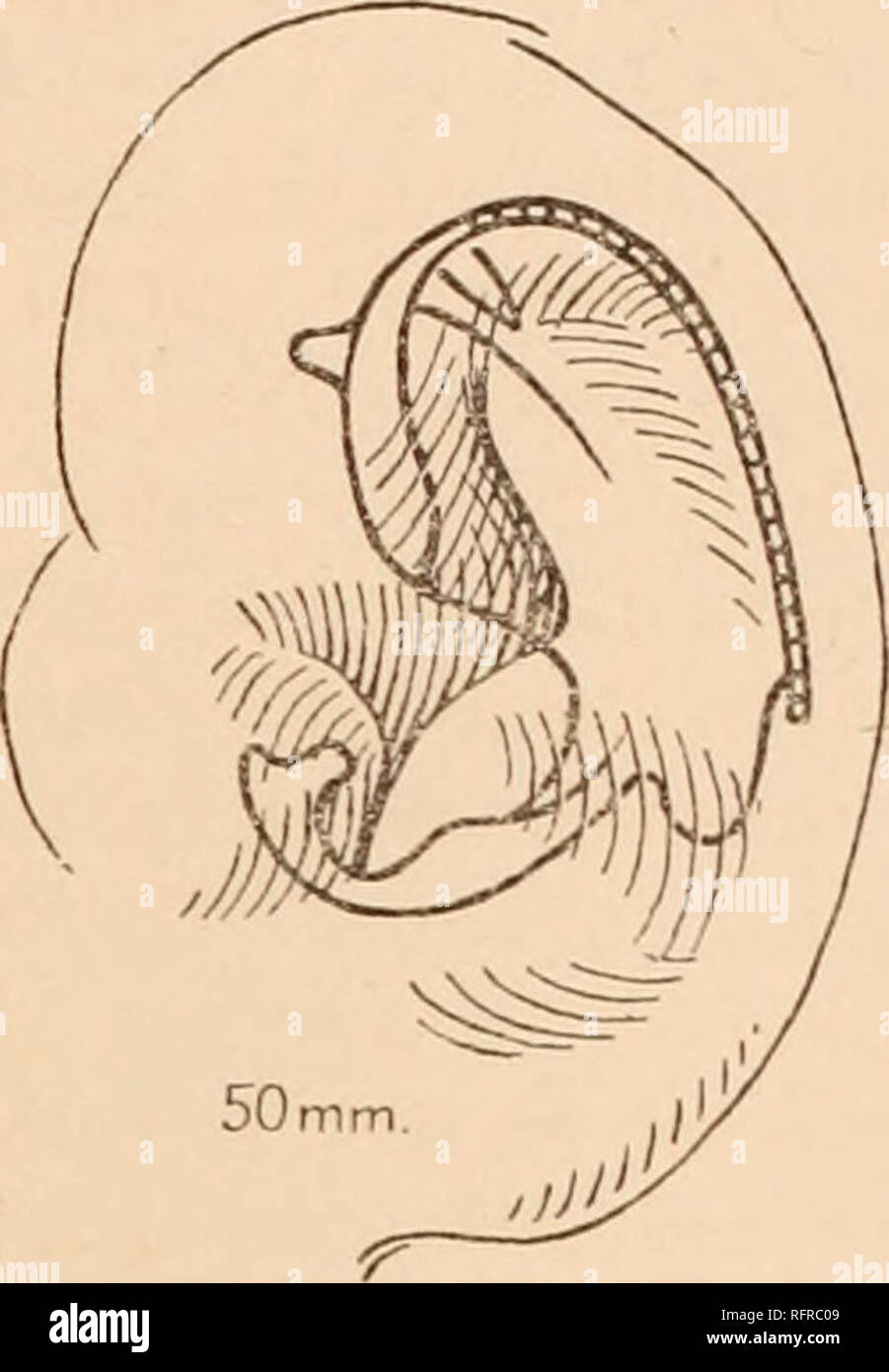 Auricular cartilage hi-res stock photography and images - Alamy