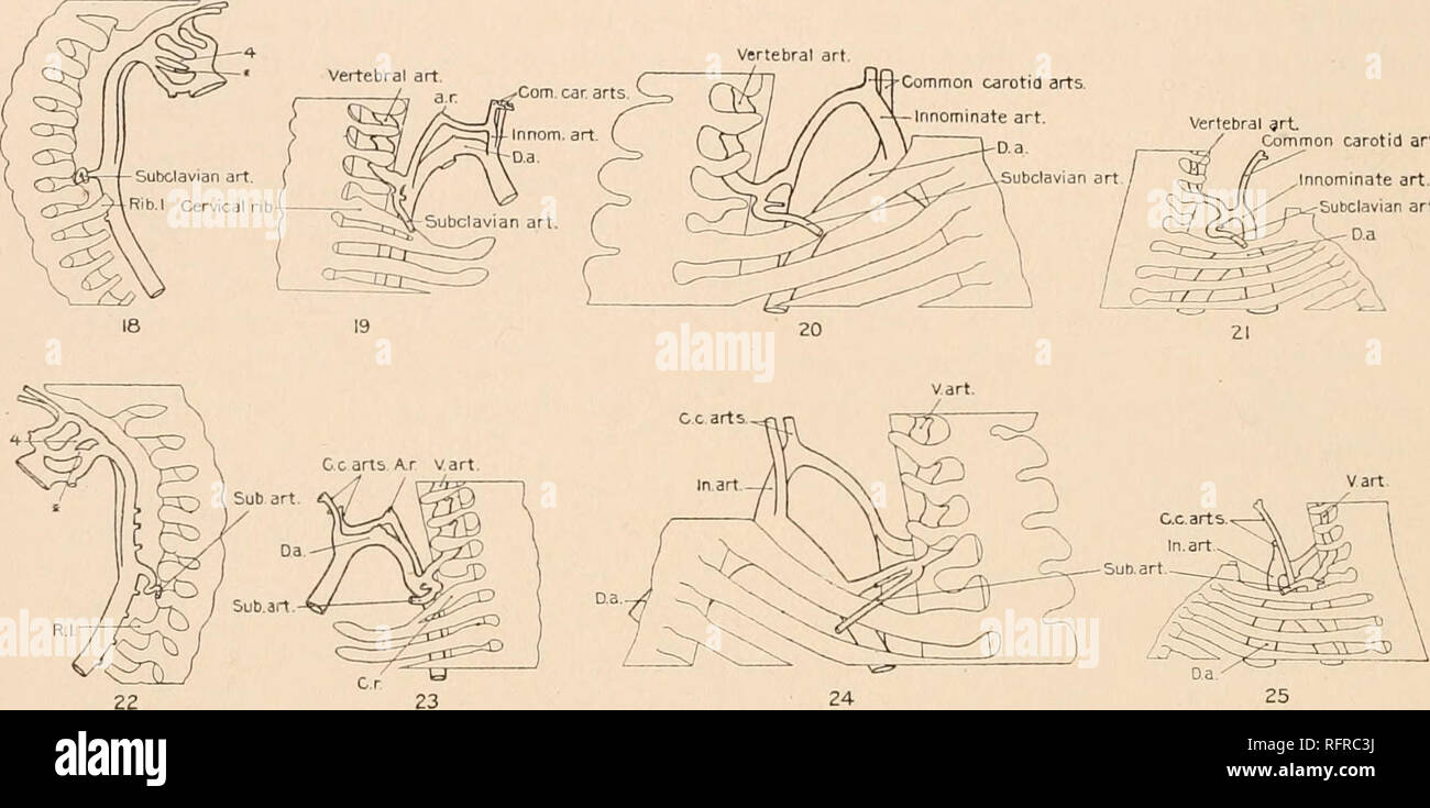 Sternal arch hi-res stock photography and images - Alamy
