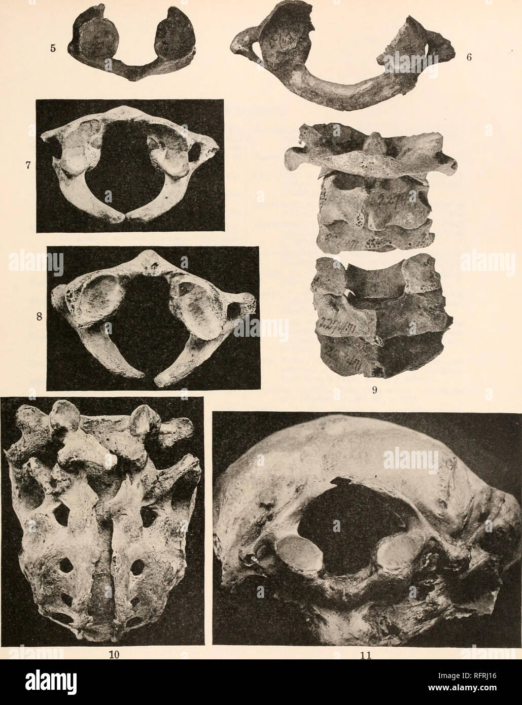 Cervical vertebrae 7 hi-res stock photography and images - Alamy