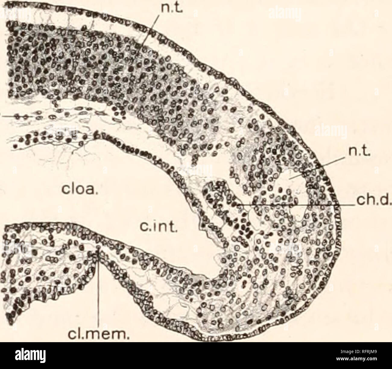 Sagittally hi-res stock photography and images - Alamy