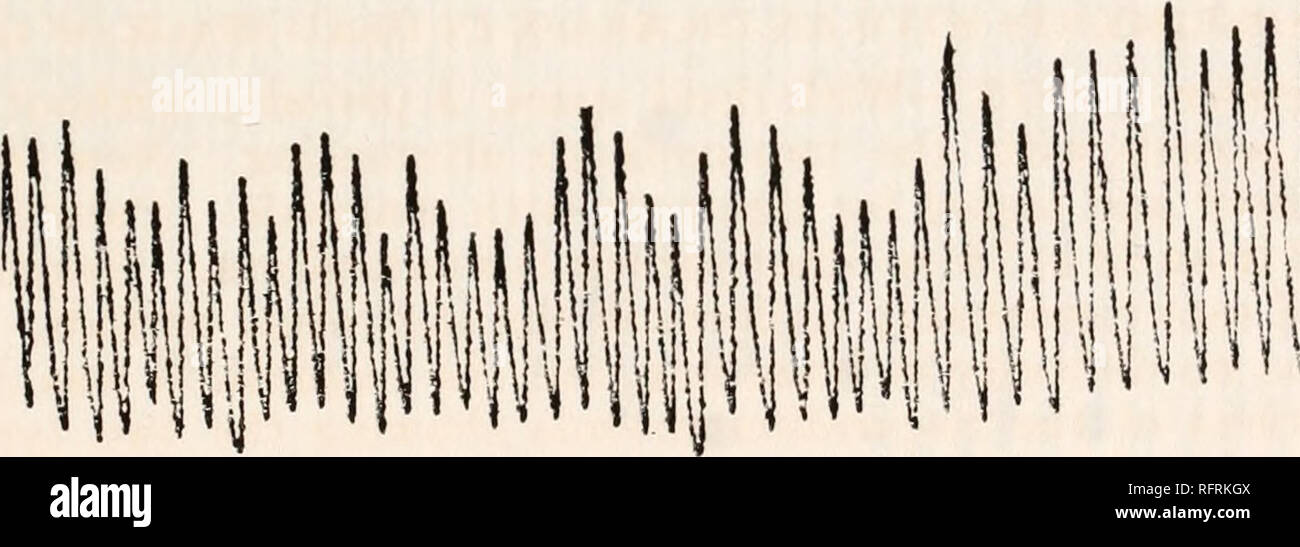 Pneumograph High Resolution Stock Photography and Images - Alamy