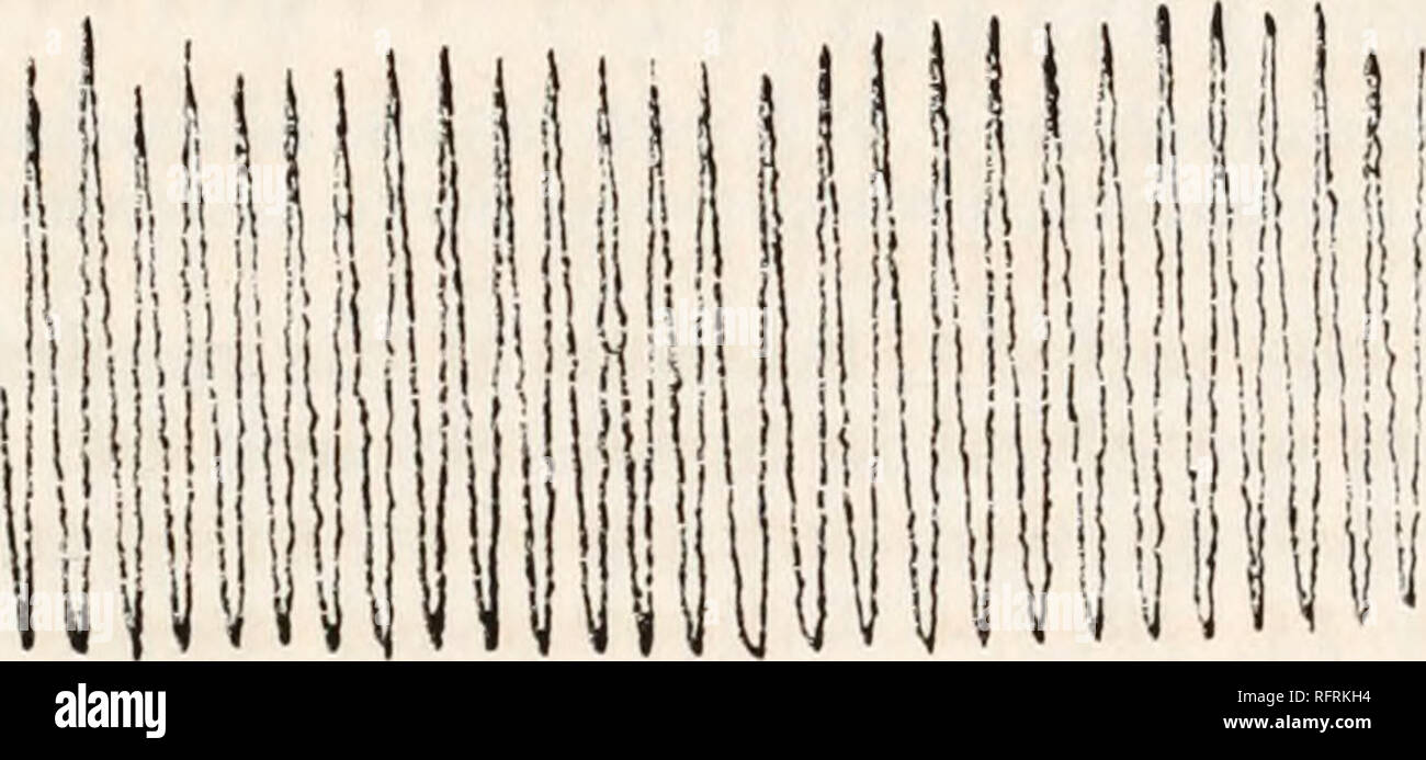 Pneumograph High Resolution Stock Photography and Images - Alamy