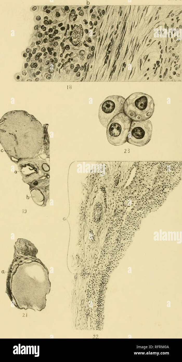 Ruptured follicle hi-res stock photography and images - Alamy