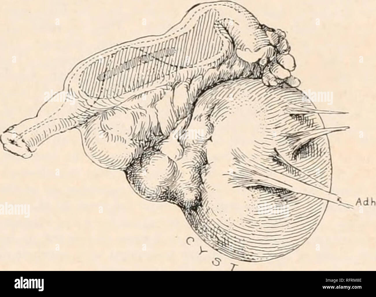 Embryo block hi-res stock photography and images - Alamy