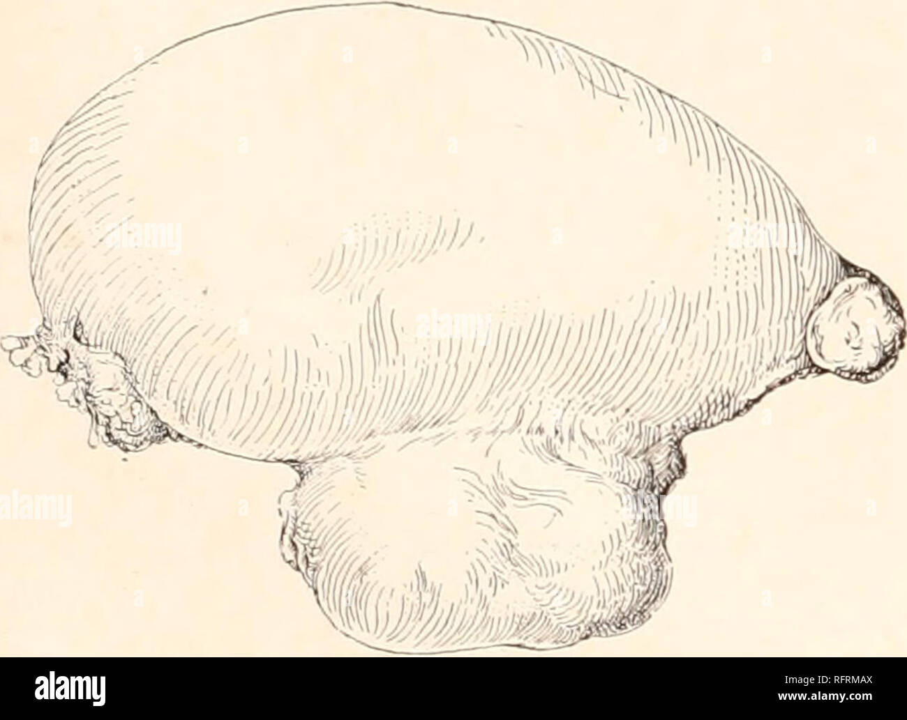 26 weeks old embryo hi-res stock photography and images - Alamy
