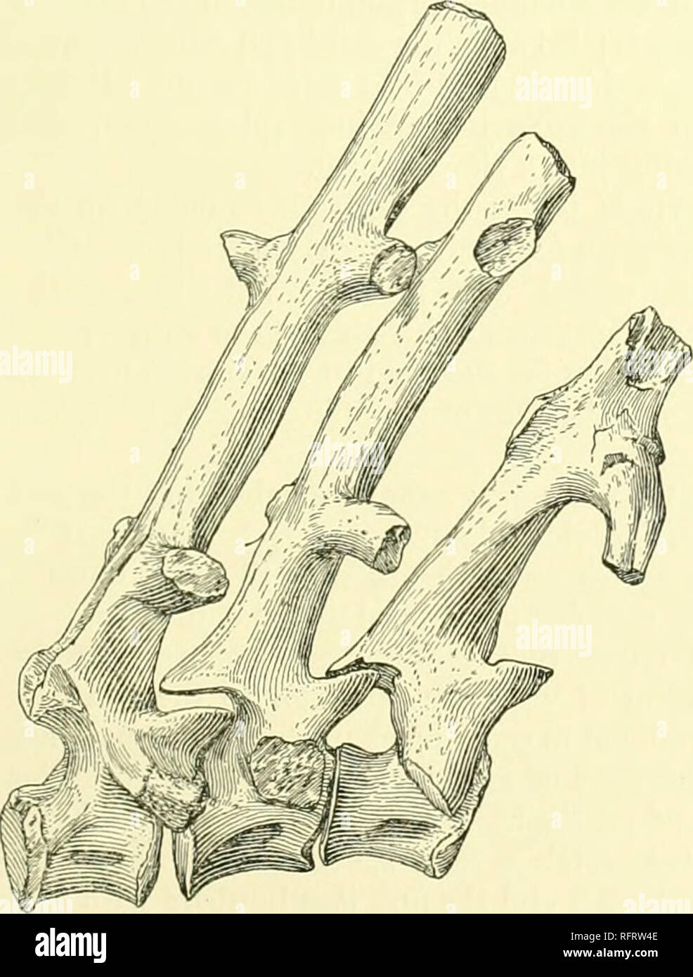 Superior temporal line of parietal bone hi-res stock photography and ...