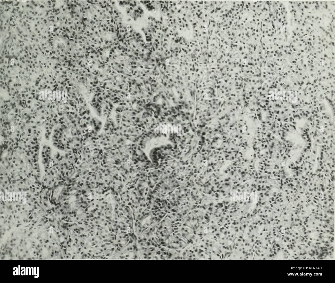 . Carcinoma of the thyroid in the salmonoid fishes. Cancer; Goiter ...