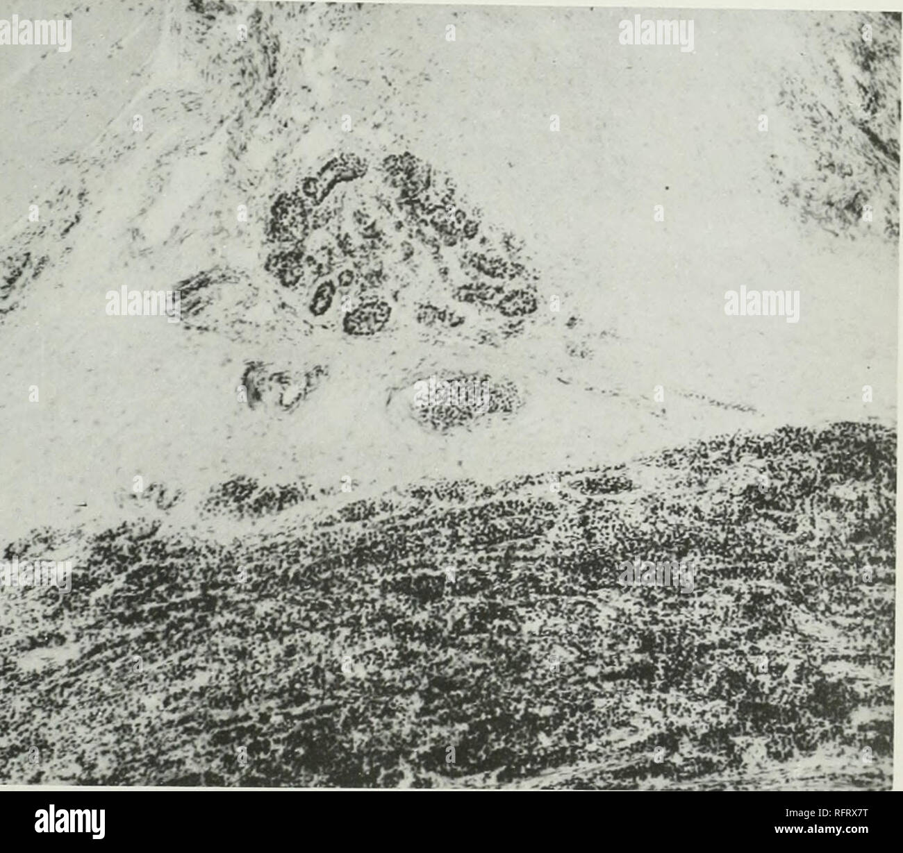 . Carcinoma of the thyroid in the salmonoid fishes. Cancer; Goiter ...