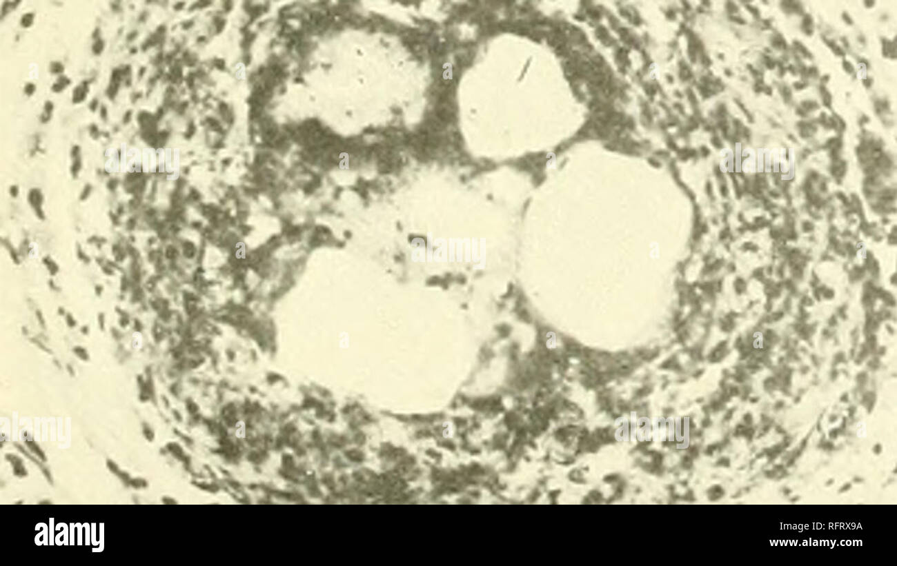 Thyroid gland cross section hi-res stock photography and images - Alamy